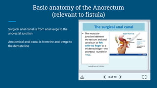 Understanding_the_fistula_in_ano_and_management_till_date.pptx