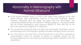 Variability And Errors When Applying The BIRADS Mammography ...