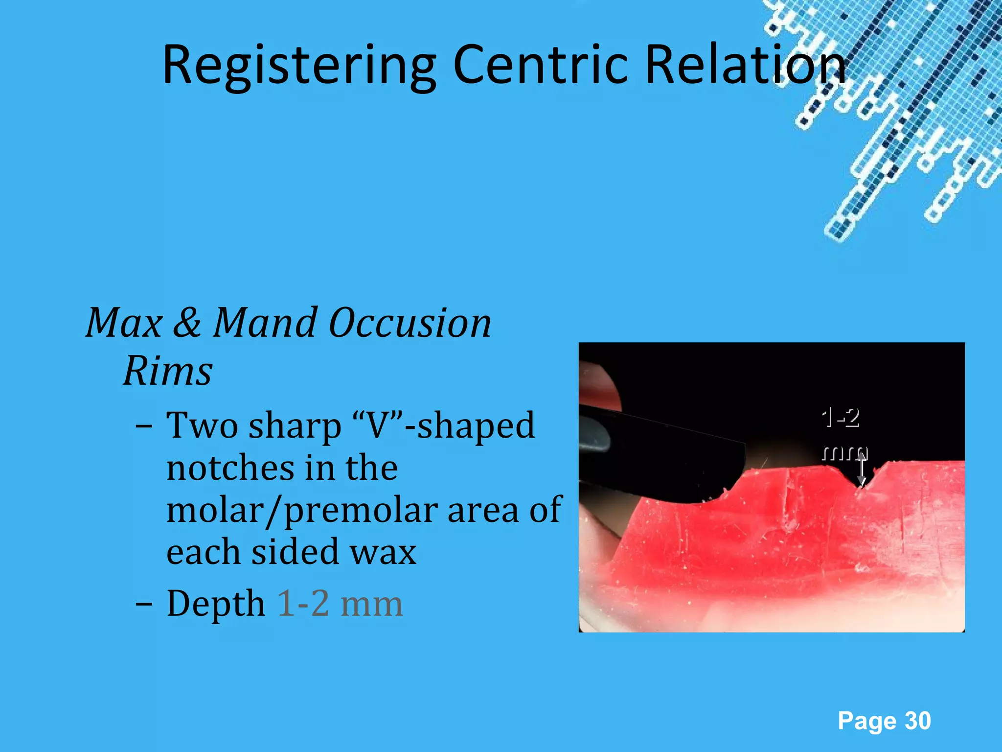 Jaw relation in complete dentures | PPT