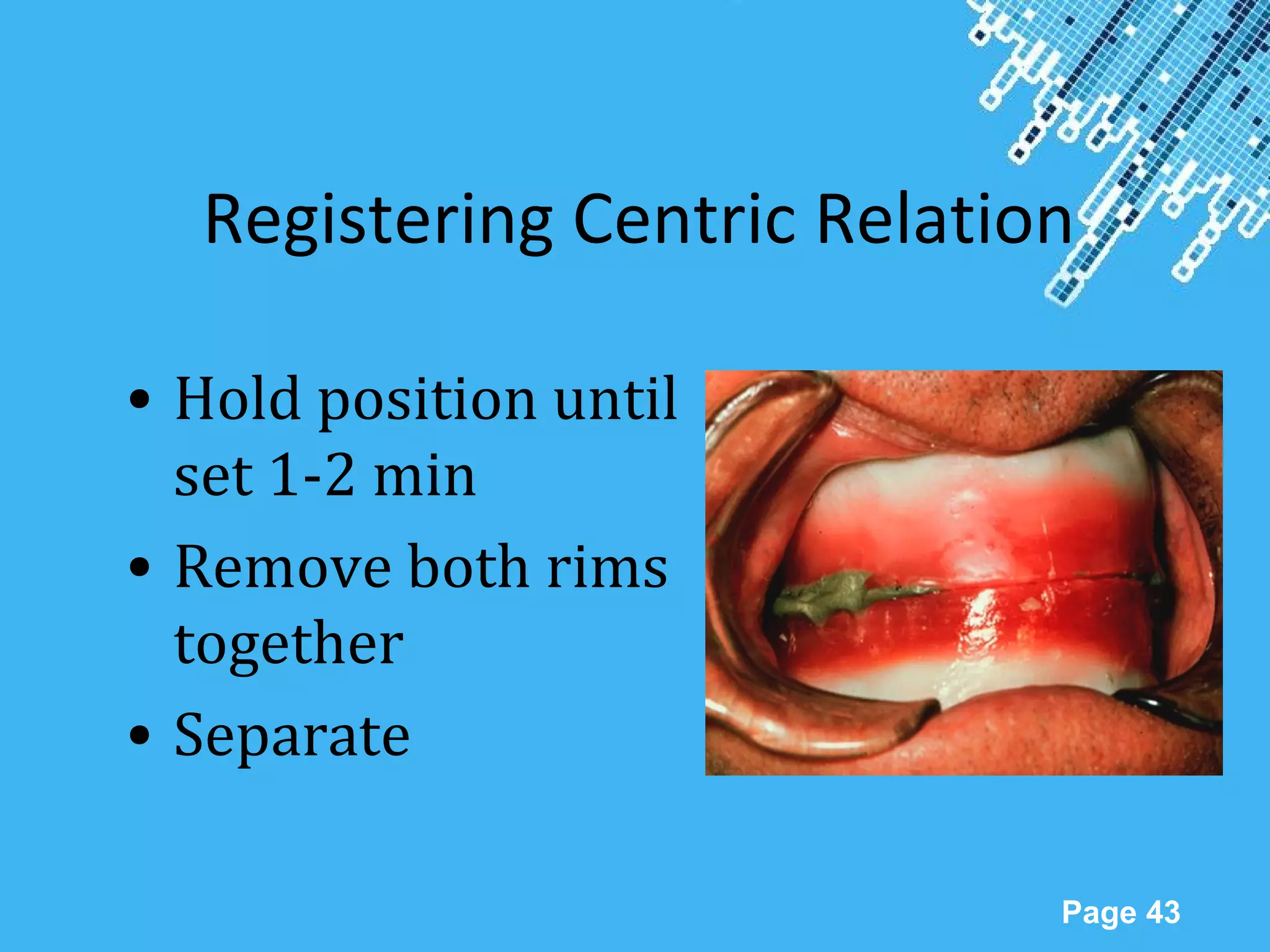 Jaw relation in complete dentures | PPT