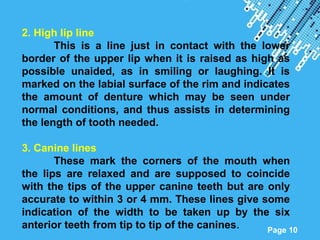 Jaw relation in complete dentures | PPT