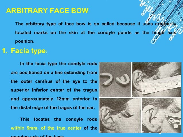 Jaw relation in complete dentures | PPT