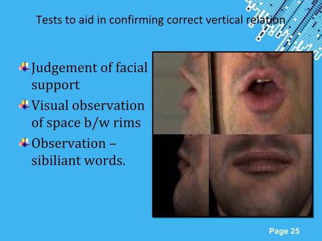 Jaw relation in complete dentures | PPT