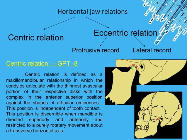 Jaw relation in complete dentures | PPT
