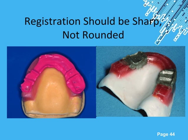 Jaw relation in complete dentures | PPT