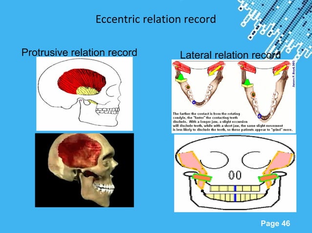 Jaw relation in complete dentures | PPT
