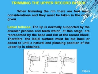 Jaw relation in complete dentures | PPT