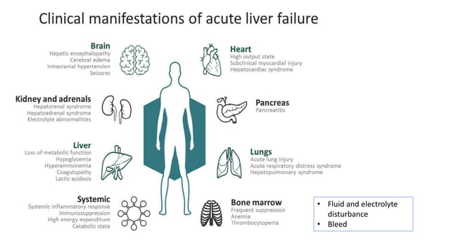 Presentation on acute liver failure.pptx