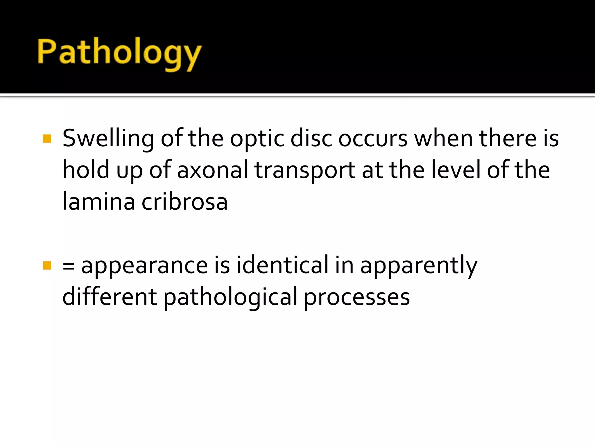 Elevated optic discs - Are they ever benign? | PPTX | Eye and Vision ...