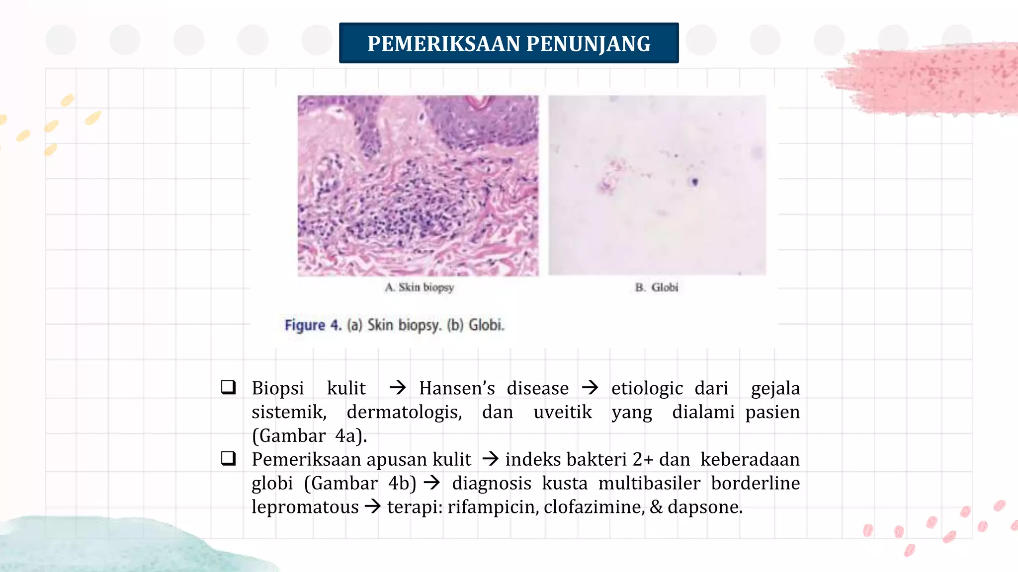 JR Mata Kelompok B_Uveitis Kronik Pada Kusta.pptx