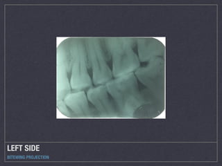 Roentgenology | PDF