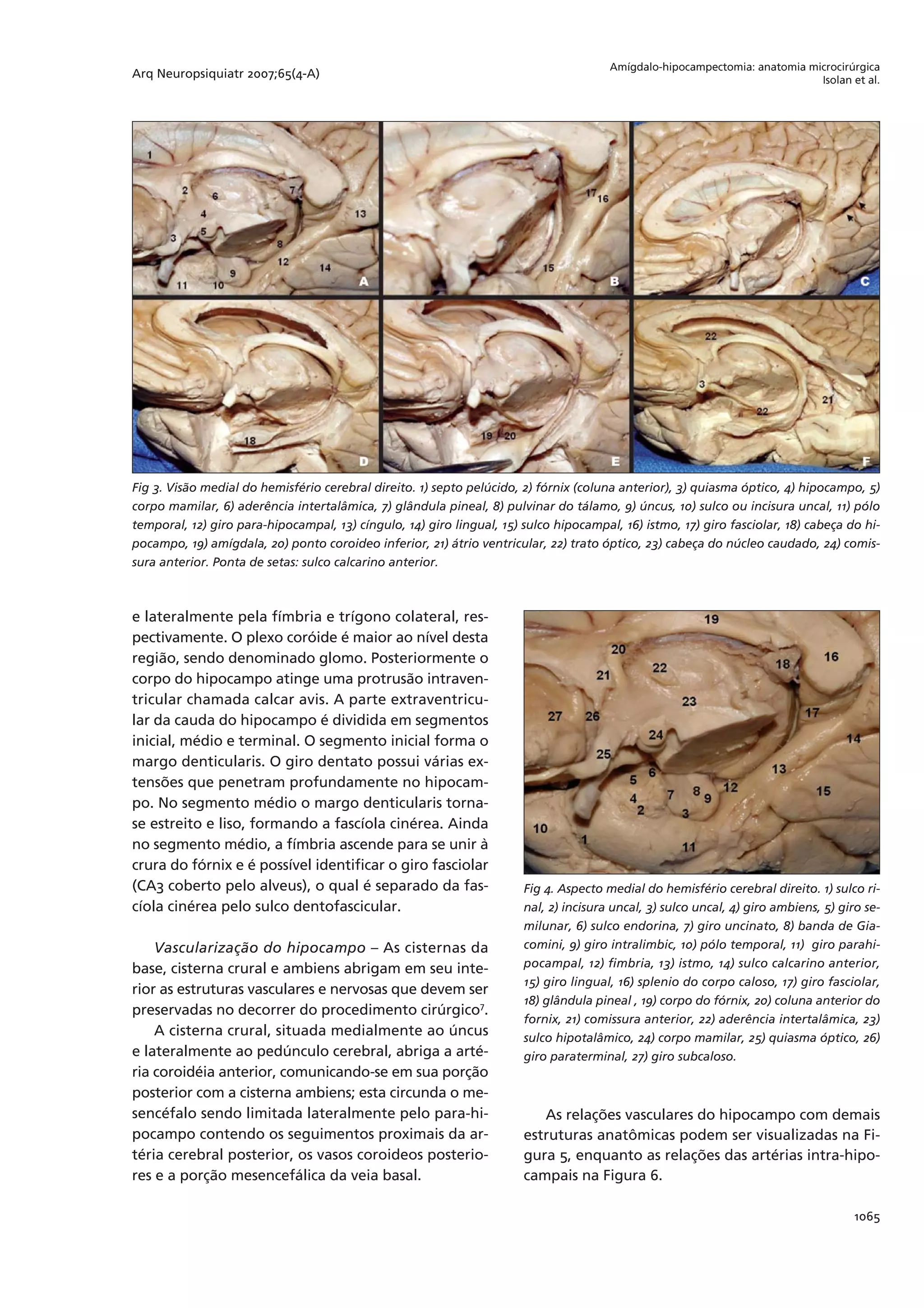 Anatomia Do Hipocampo Coronal Hippocampus Anatomy Coronal