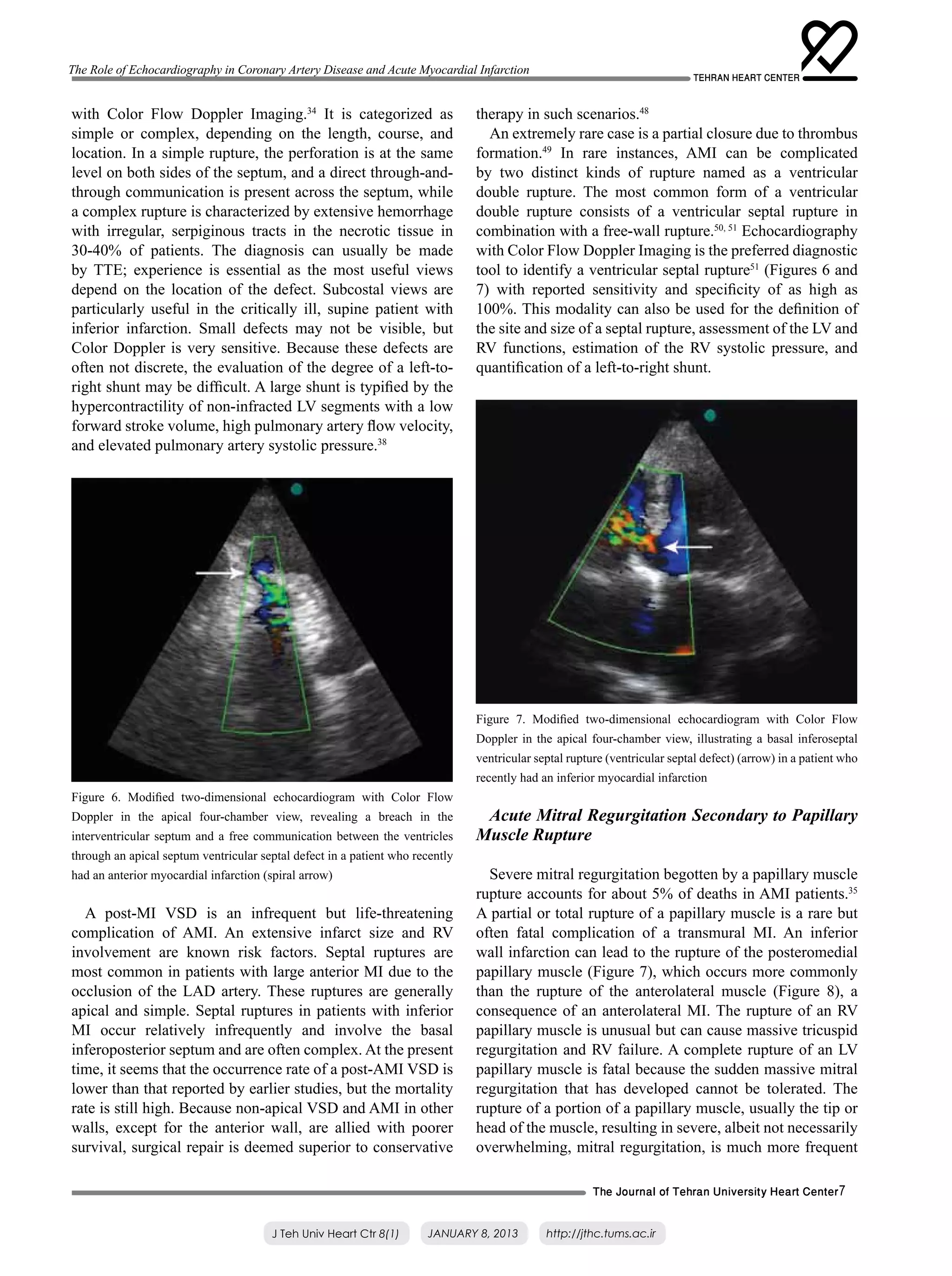 The role of Echocardiography In coronary artery disease and Acute ...