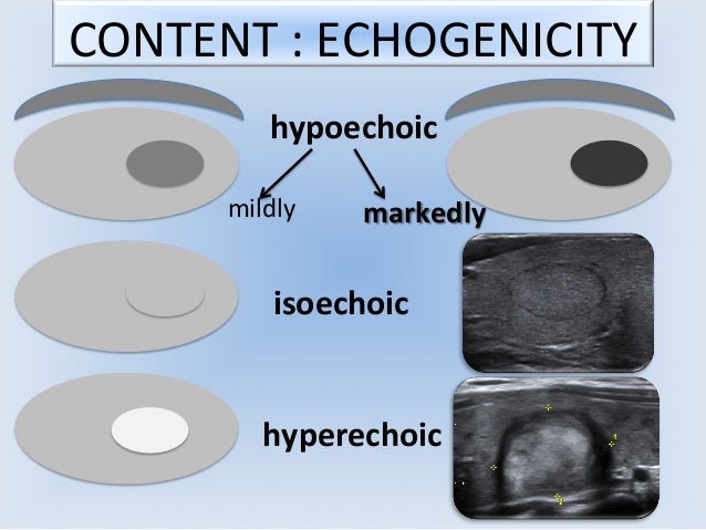J tramalloni thyroid tirads classification practical applications jf…