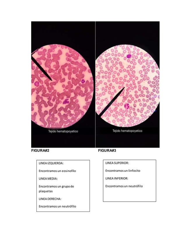 TEJIDOS: hematopoyetico, mieloide, linfoide y sanguineo