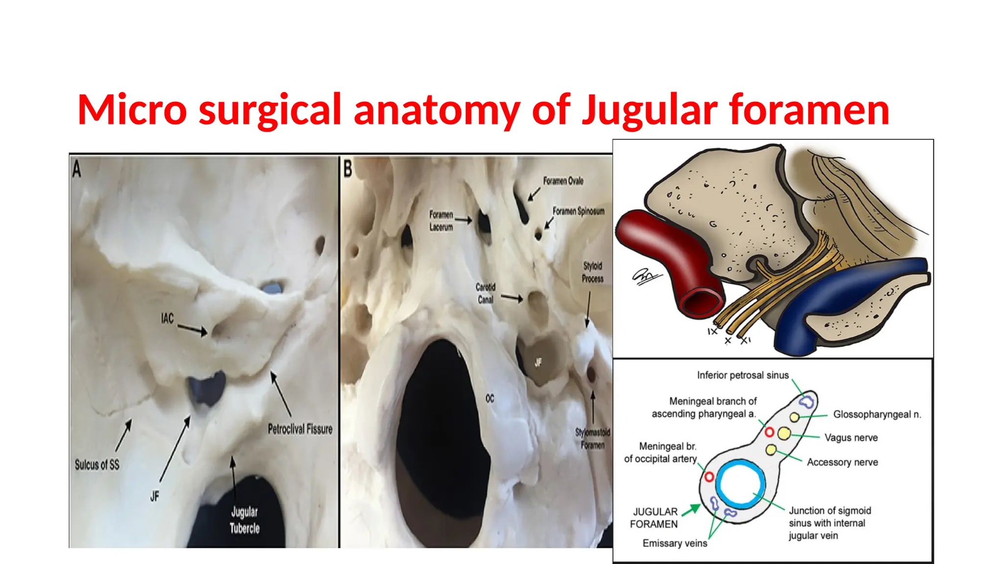 jugular foramen anatomy in neuro anatomy | PPTX