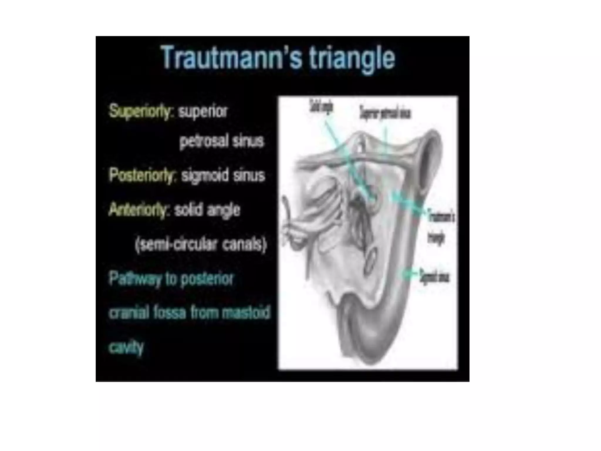 Jugular foramen anatomy and approaches | PPTX