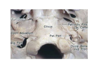 Jugular foramen anatomy and approaches | PPTX