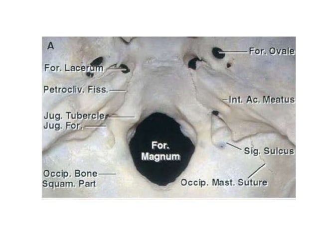 Jugular foramen anatomy and approaches