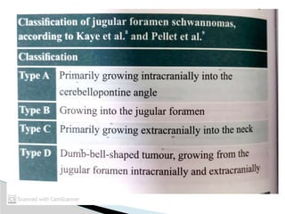 Jugular foramen lesions and their management.pptx