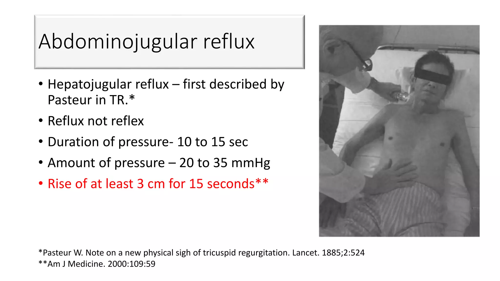 Jugular venous pressure | PPTX | Heart and Cardiovascular Diseases ...