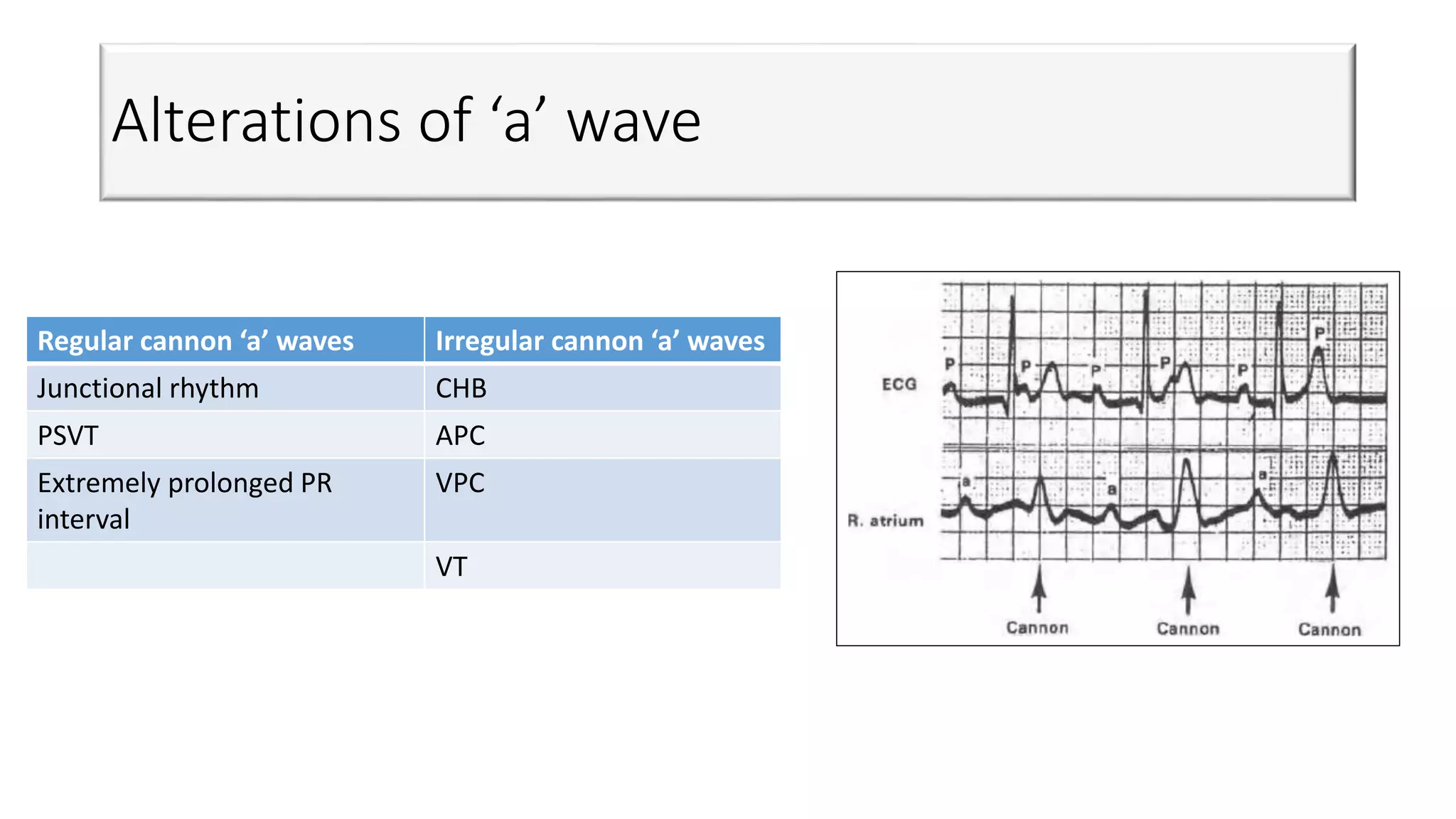 Jugular venous pressure | PPTX | Heart and Cardiovascular Diseases ...