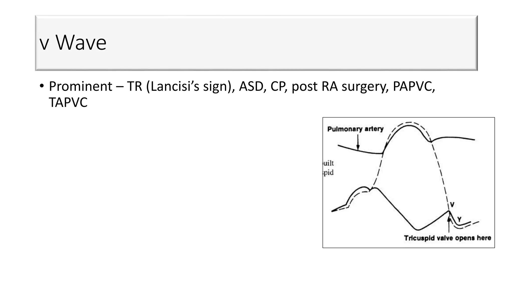 Jugular venous pressure | PPTX | Heart and Cardiovascular Diseases ...