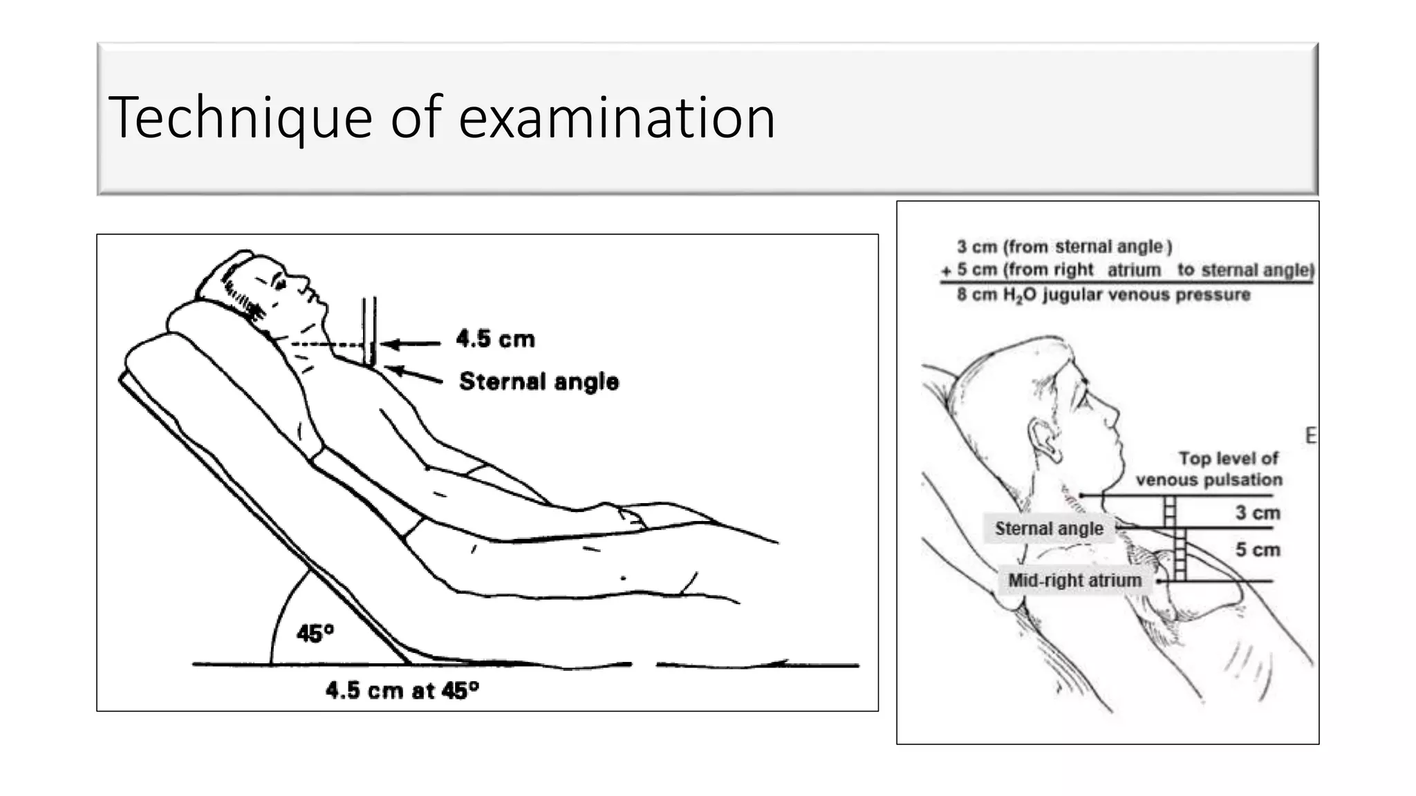 Jugular venous pressure | PPTX