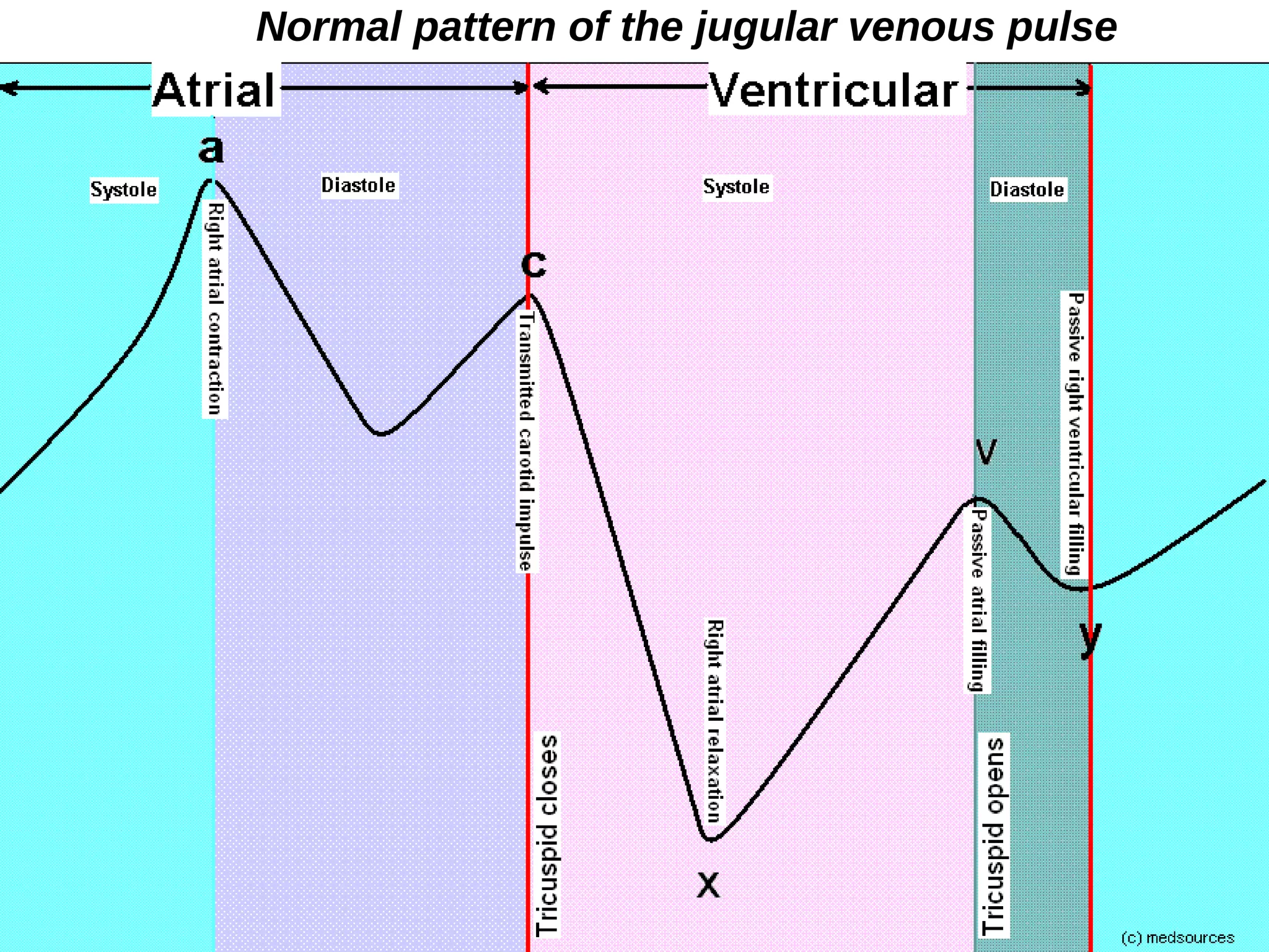 Jugular Venous Pressure (JVP) Jugular Venous Pulse | PPT