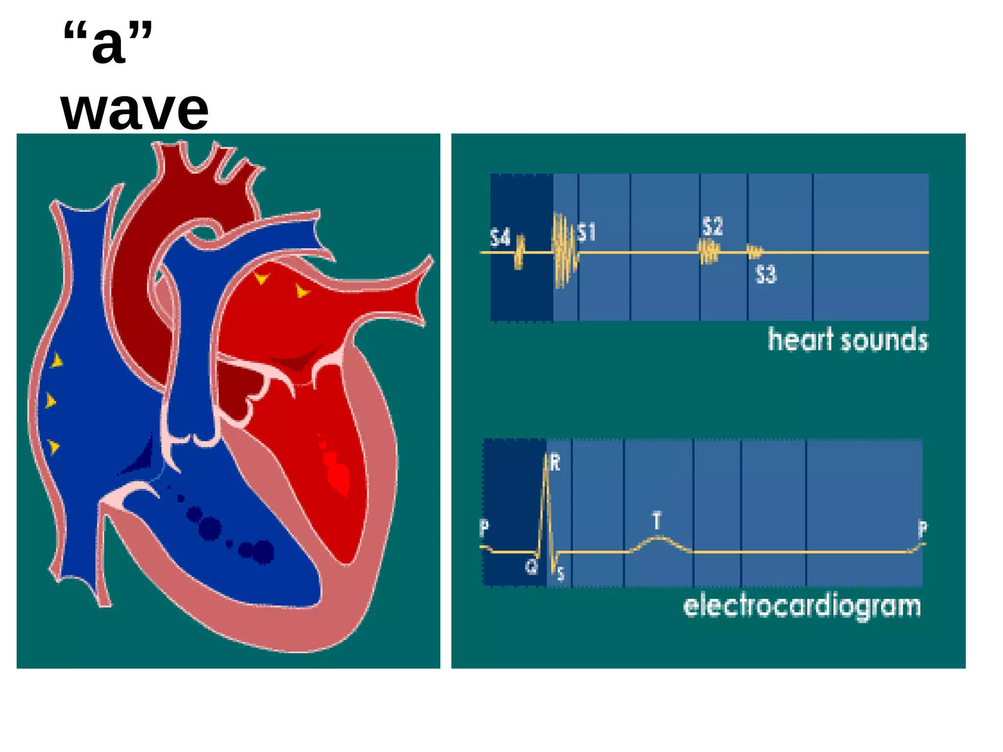 Jugular Venous Pressure (JVP) Jugular Venous Pulse | PPT