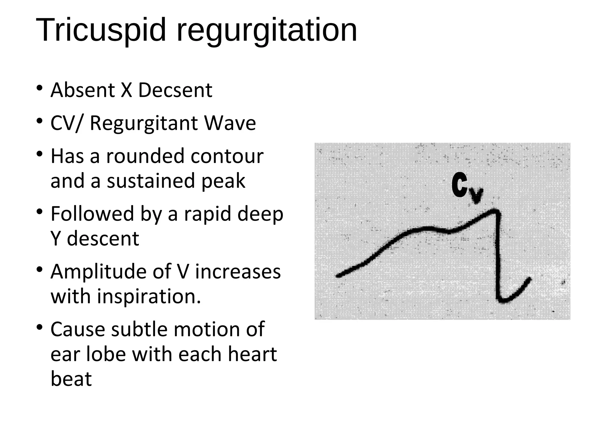 Jugular Venous Pressure (JVP) Jugular Venous Pulse | PPT