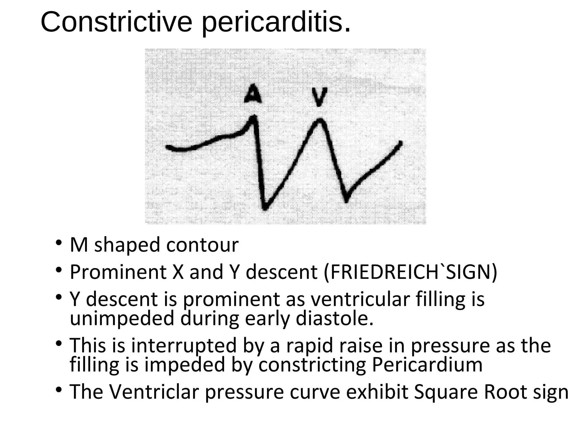 Jugular Venous Pressure (JVP) Jugular Venous Pulse | PPT