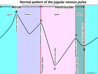 Jugular Venous Pressure (JVP) Jugular Venous Pulse | PPT