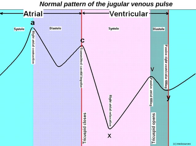 Jugular Venous Pressure (JVP) Jugular Venous Pulse | PPT