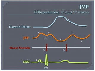 Jugular Venous Pressure (JVP) Jugular Venous Pulse | PPT