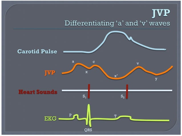 Jugular Venous Pressure (JVP) Jugular Venous Pulse | PPT