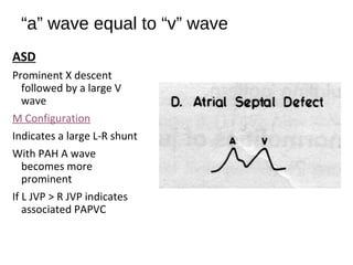 Jugular Venous Pressure (JVP) Jugular Venous Pulse | PPT