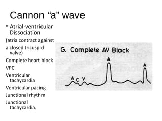 Jugular Venous Pressure (JVP) Jugular Venous Pulse | PPT