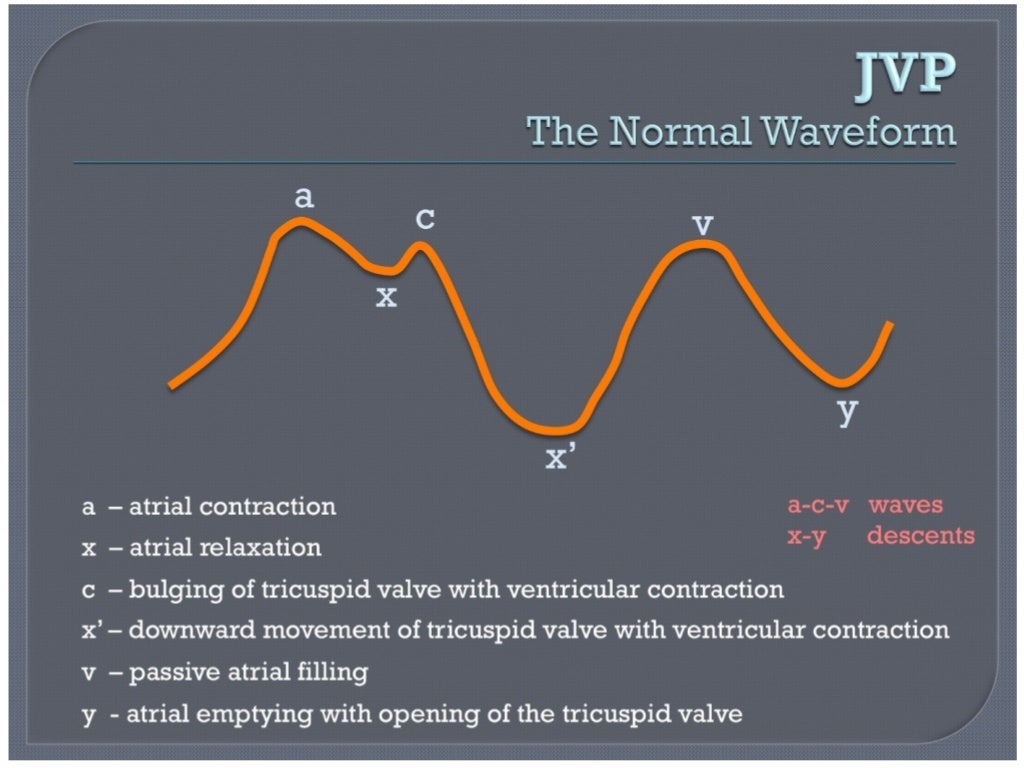 Jugular Venous Pressure (JVP) Jugular Venous Pulse