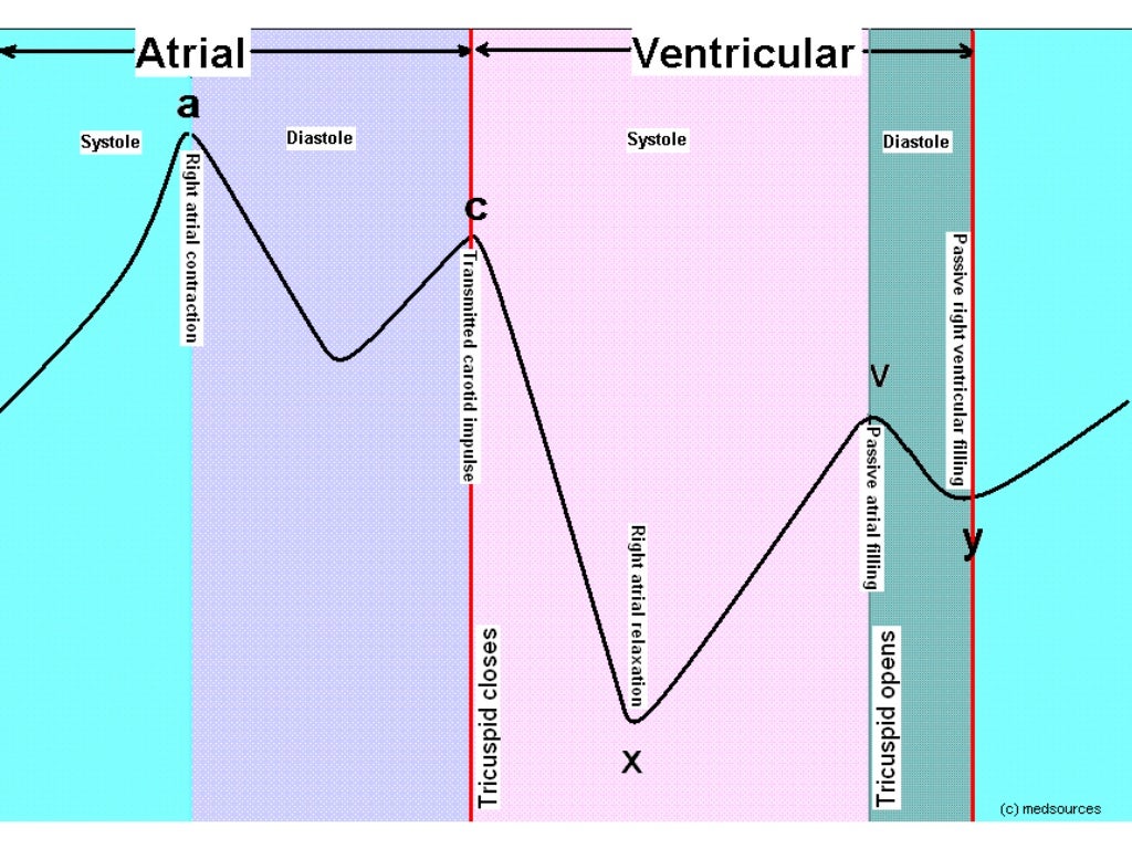 Jugular Venous Pressure (JVP) Jugular Venous Pulse