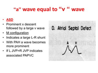 Jugular venous pressure and pulse pptx | PPTX