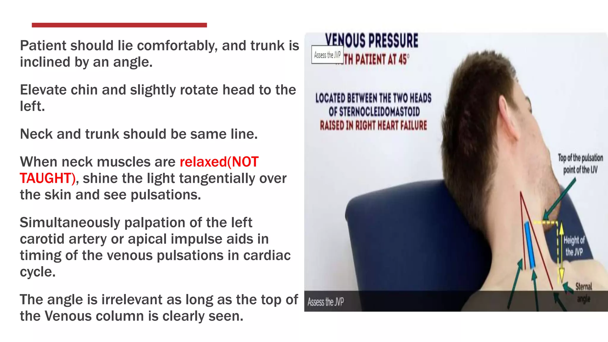 Jugular Venous Pressure jvp.pptx