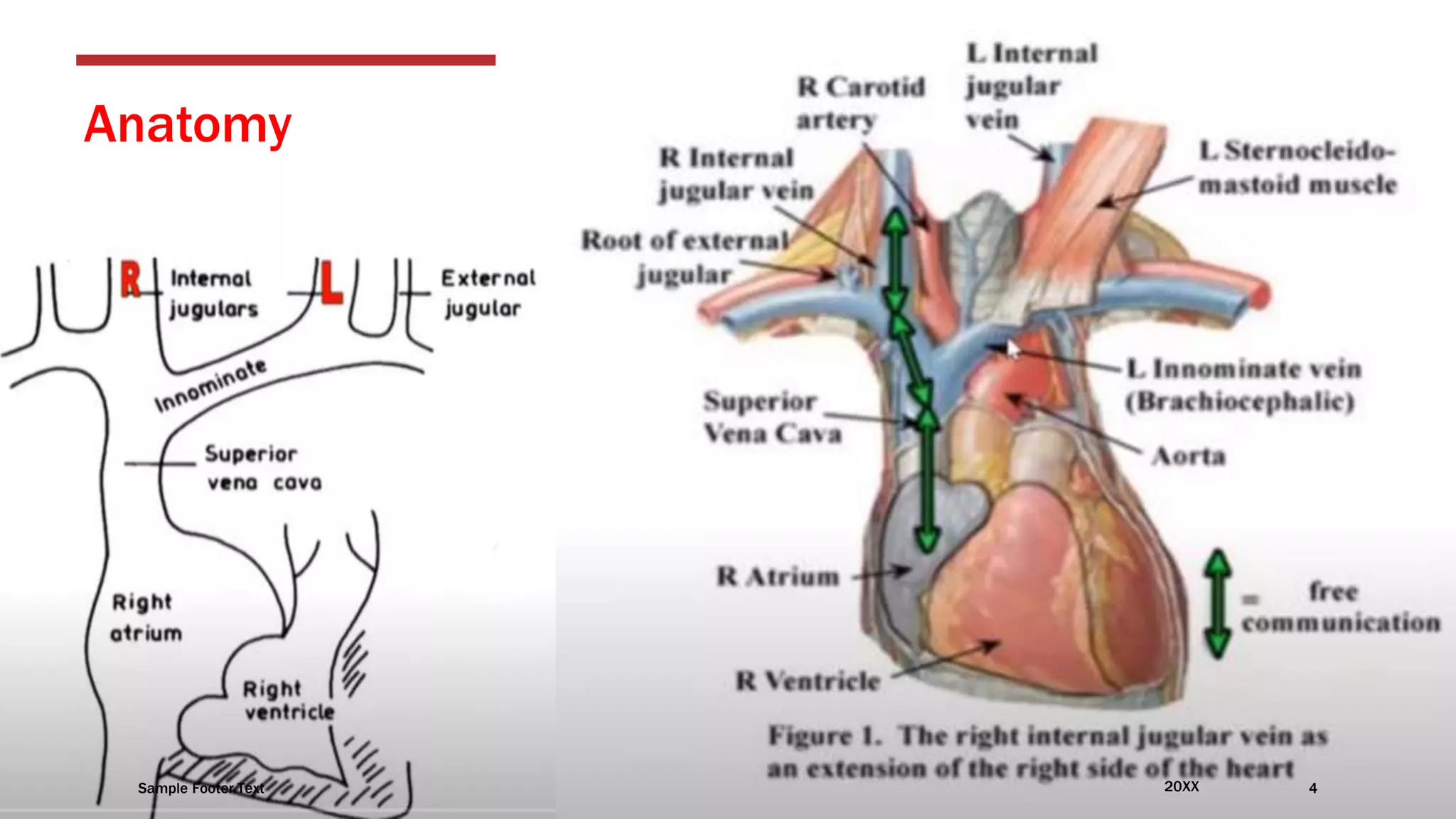 Jugular Venous Pressure jvp.pptx