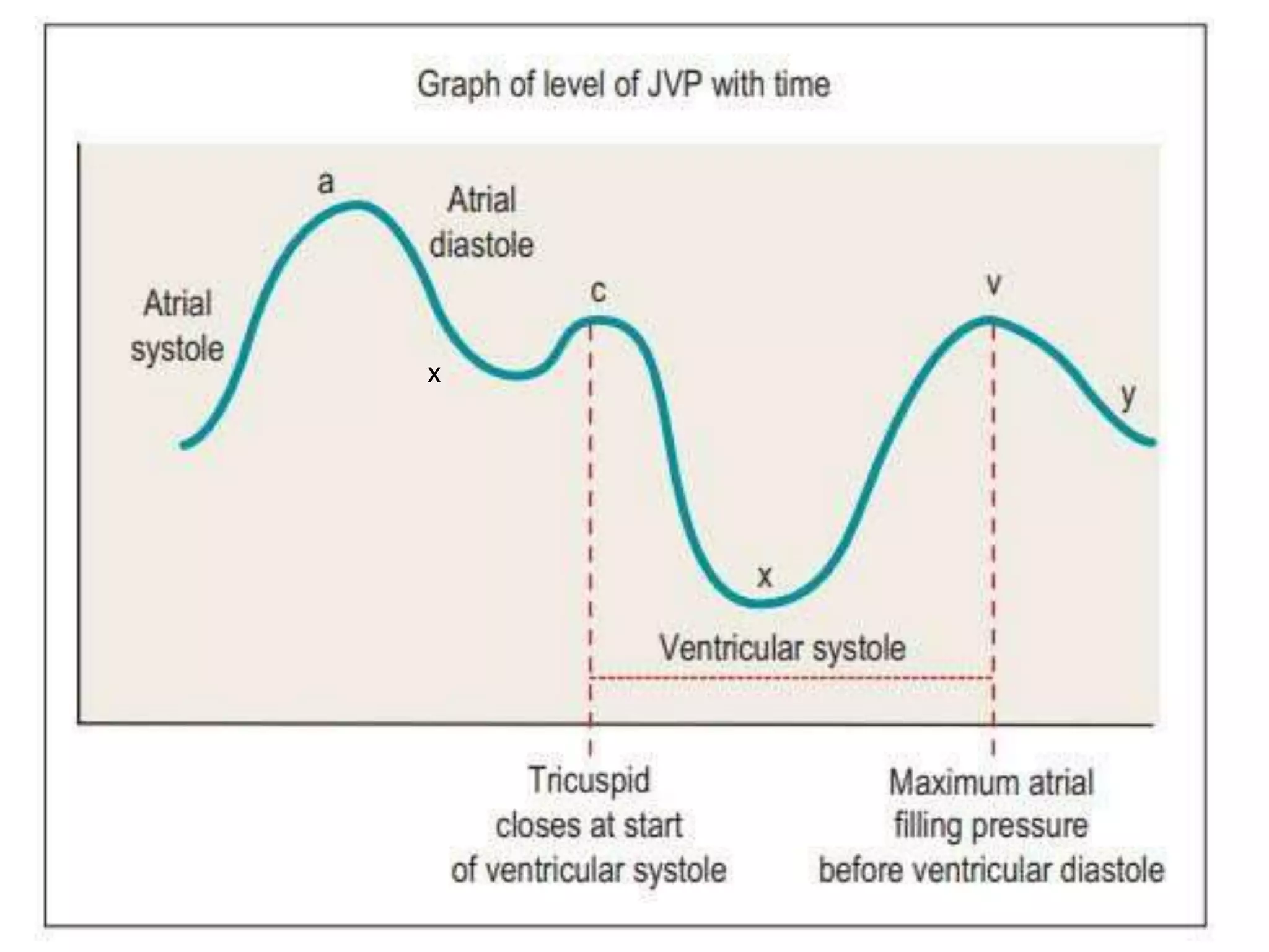Jugular Venous Pulse (JVP).pptx