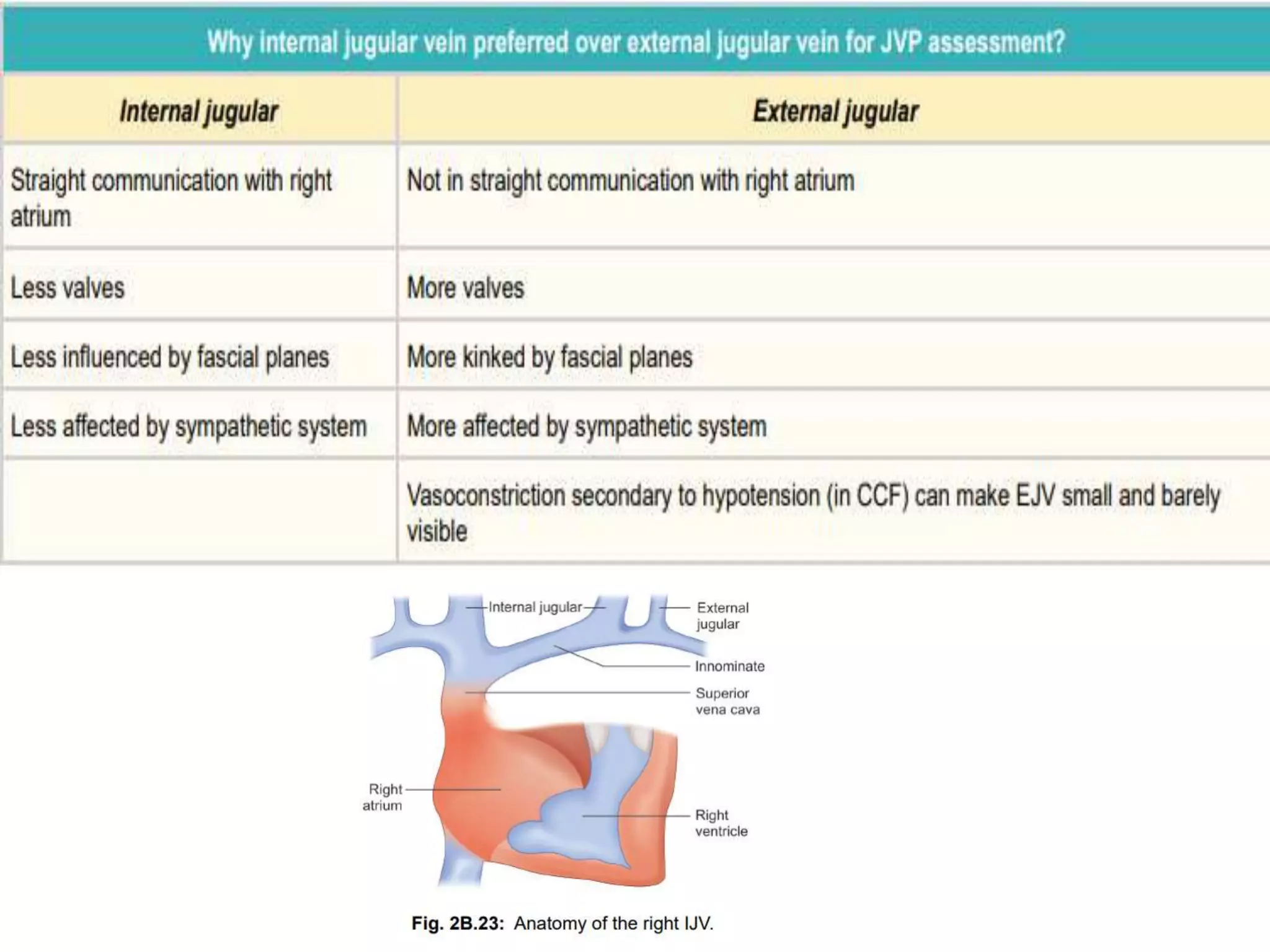 Jugular Venous Pulse (JVP).pptx