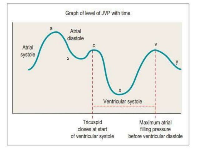 Jugular Venous Pulse (JVP).pptx