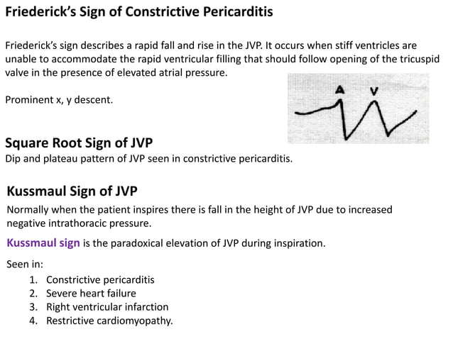 Jugular Venous Pulse (JVP).pptx