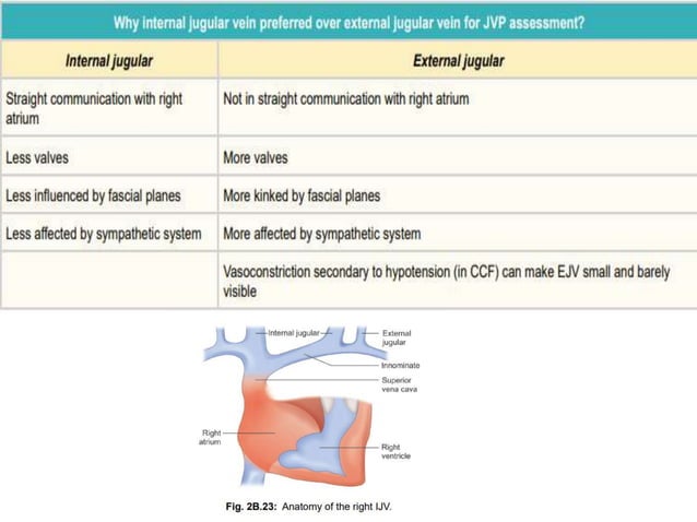 Jugular Venous Pulse (JVP).pptx