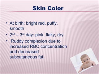 Ruddy Complexion Newborn