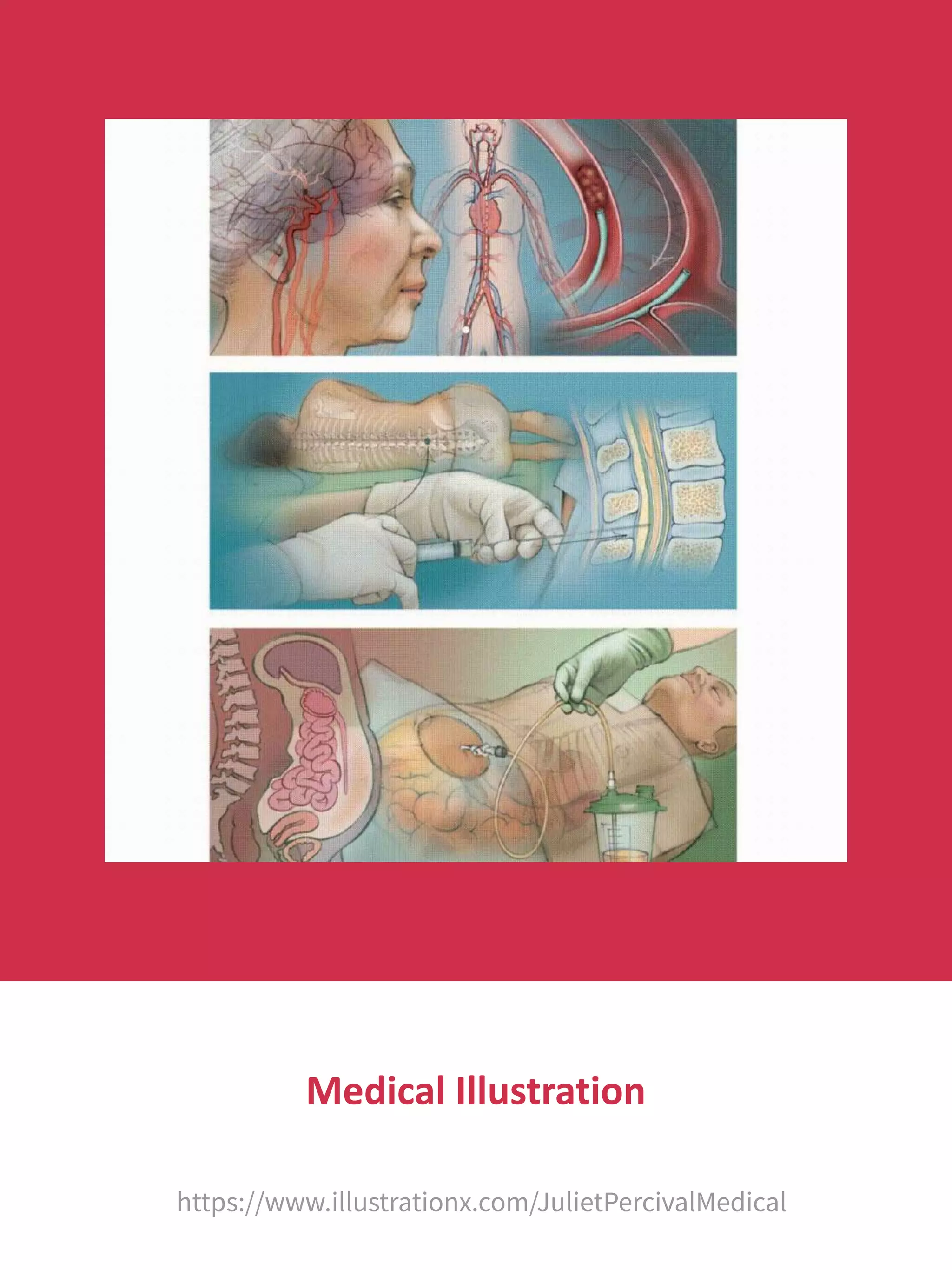 Juliet Percival Medical - Medical & Scientific Illustrator, UK.pdf